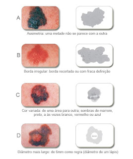 Prevenção de câncer: O que é câncer?